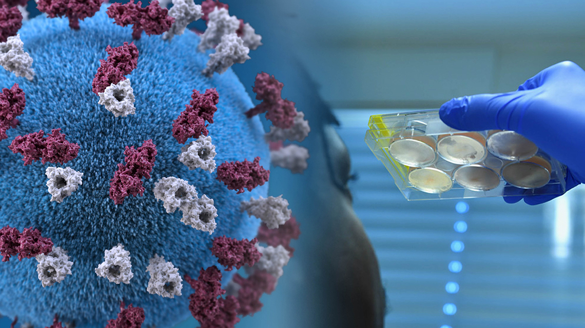 Detección del virus de la COVID-19 mediante la RT-PCR en tiempo real | OIEA Detección del virus de la COVID-19 mediante la RT-PCR en tiempo real | OIEA